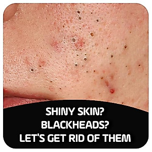 Asepxia with Activated Charcoal Purifying Effect Acne Treatment Bar Soap with Salicylic Acid, 4 Ounce