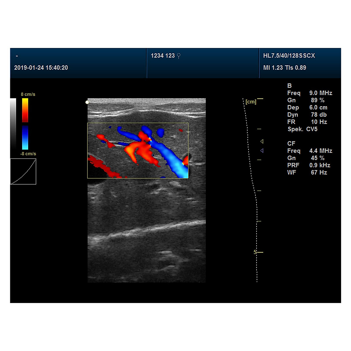 CONTEC CMS1700A-VET/Veterinary Color Doppler ultrasonic Systems (Rectal Linear, Convex Probe)