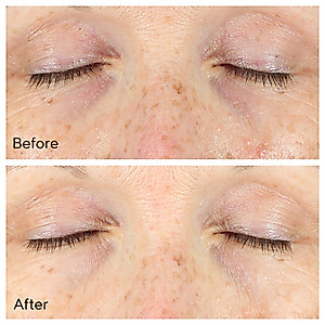 Murad Vita-C Eyes Dark Circle Corrector – Environmental Shield Vitamin C Brightening Serum – Anti-Aging Treatment for Puffiness and Wrinkles, 0.5 Fl Oz