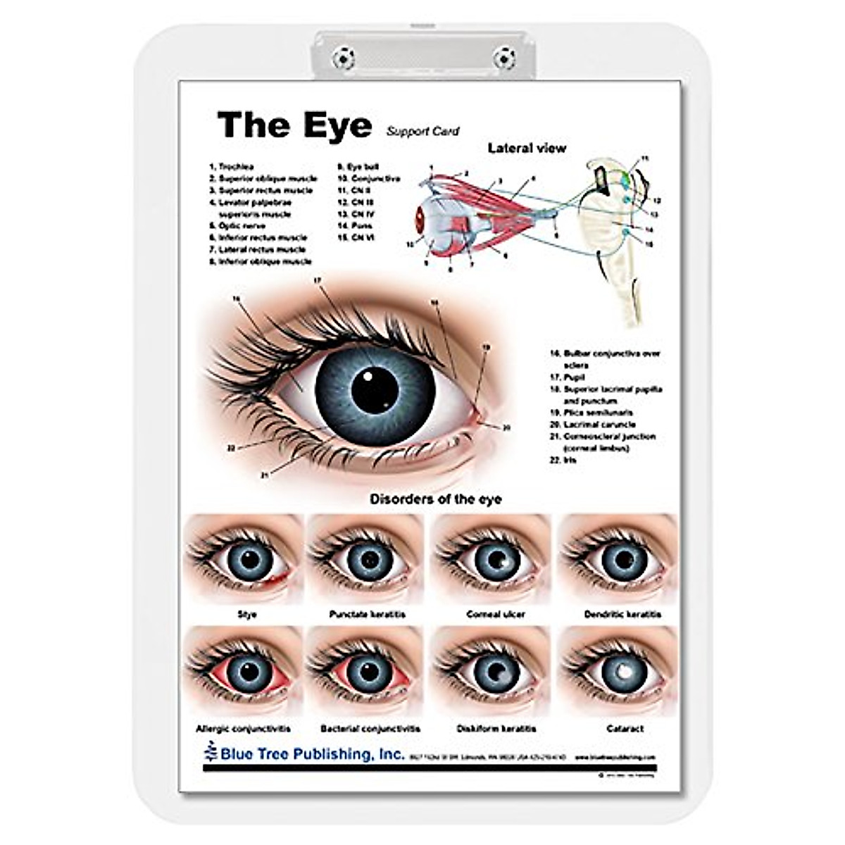 Eye Insert clipboard