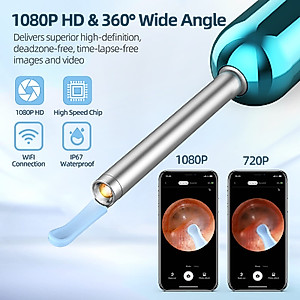 Ear Wax Removal, Ear Cleaner with Camera with 1080P, Otoscope with Light, Ear Wax Removal Kit with 6 Ear Pick, Ear Camera for iPhone, iPad, Android Phones (White)