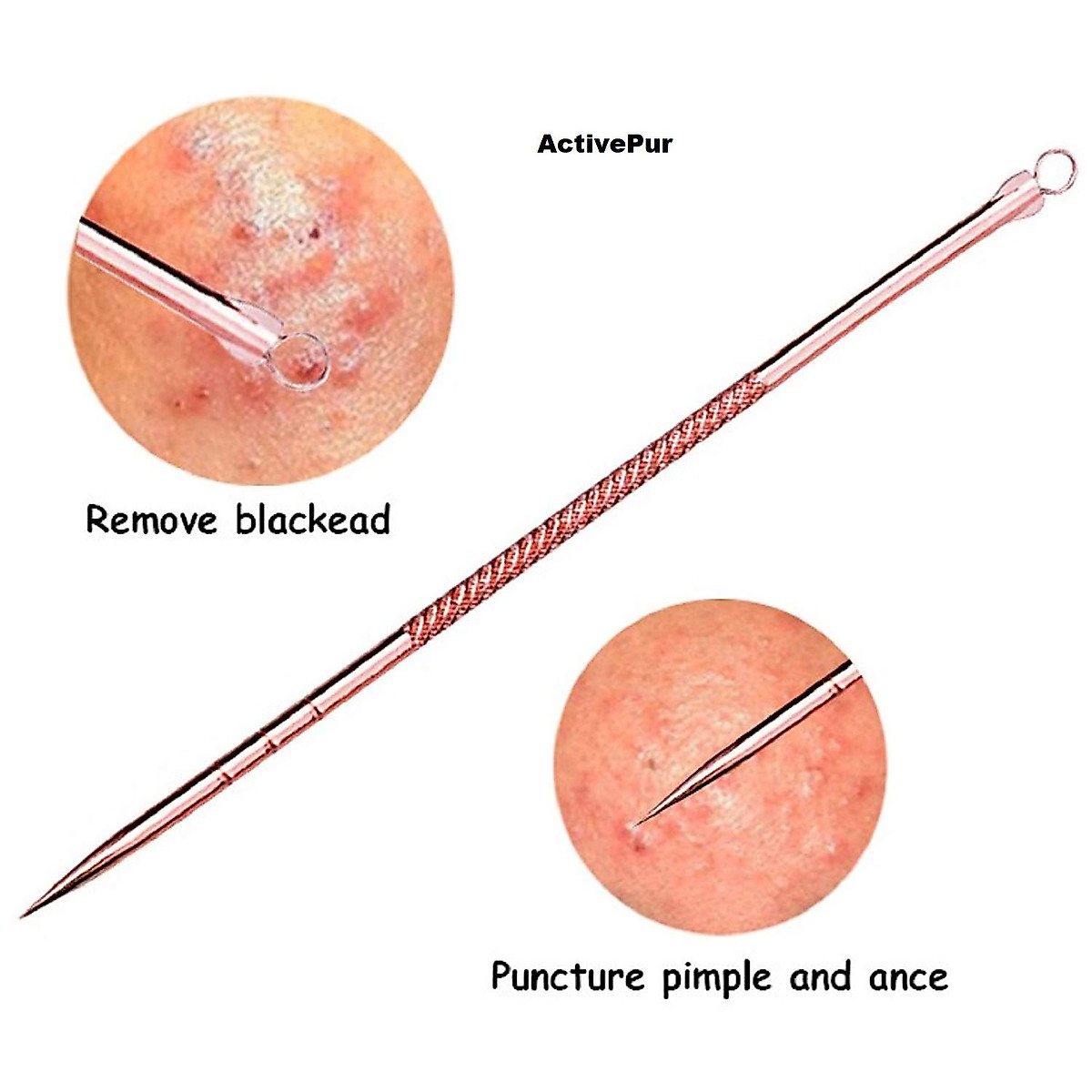Blackhead Remover Pimple Comedone Extractor Tool, Effective Acne Removal Kit, Treatment for Blemish, Whitehead Pimple Popping, Zit Removing for Nose & Face Skin, Best Electroplated 4 PCS w/case.