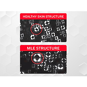 ATOPALM Intensive Moisturizing Cream for Dry & Sensitive Skin, Face Moisturizer, Replenishes Hydration, Paraben-Free, K-Beauty, skin barrier ceramide cream, 3.4 Fl Oz, 100ml (3.4 Fl Oz)