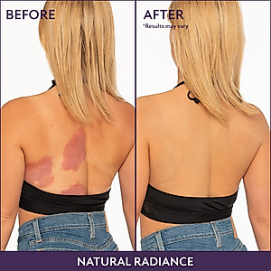 Westmore Beauty Skin Foundation Concealer, Body Makeup 3.5 Fl Oz (Golden Radiance, Cream) - Waterproof, Transfer-Resistant, Long-Lasting Coverage for Tattoo, Stretch Marks, Scars