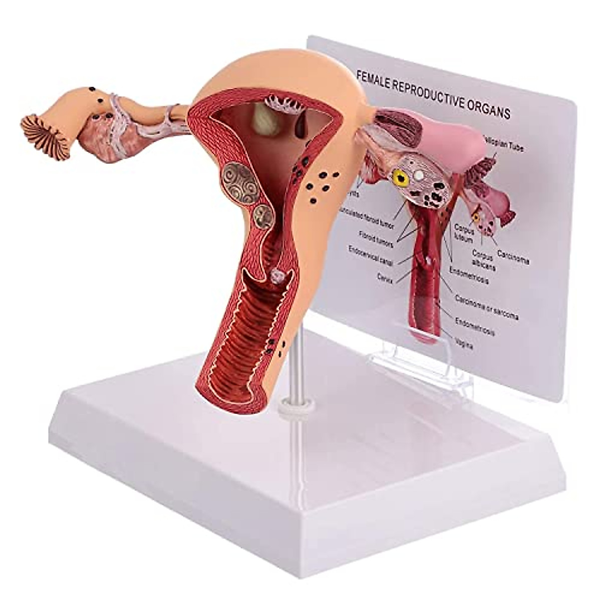 ROLTIN Human Pathological Uterus Model Internal Reproductive System Organ Anatomical Model Human Anatomy Model for Medical Training Aid