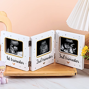 Amyhill Triple Ultrasound Picture Frames, Baby Sonogram Photo Frame Pregnancy Ultrasound Keepsake Frame, Gift for Expecting Parents, Baby Shower Baby Nursery Decor, White