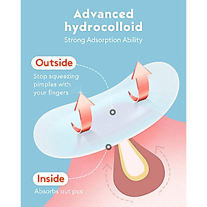 LitBear Large Acne Pimple Patches, 5 Sizes 80 Patches for Large Breakouts, Acne Patches for Face, Chin or Body, Acne Spot Patch with Tea Tree & Calendula Oil, Hydrocolloid Bandages for Acne Skin