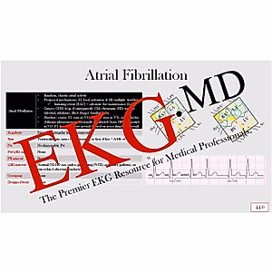 Ultimate EKG Breakdown - The EKG Guy