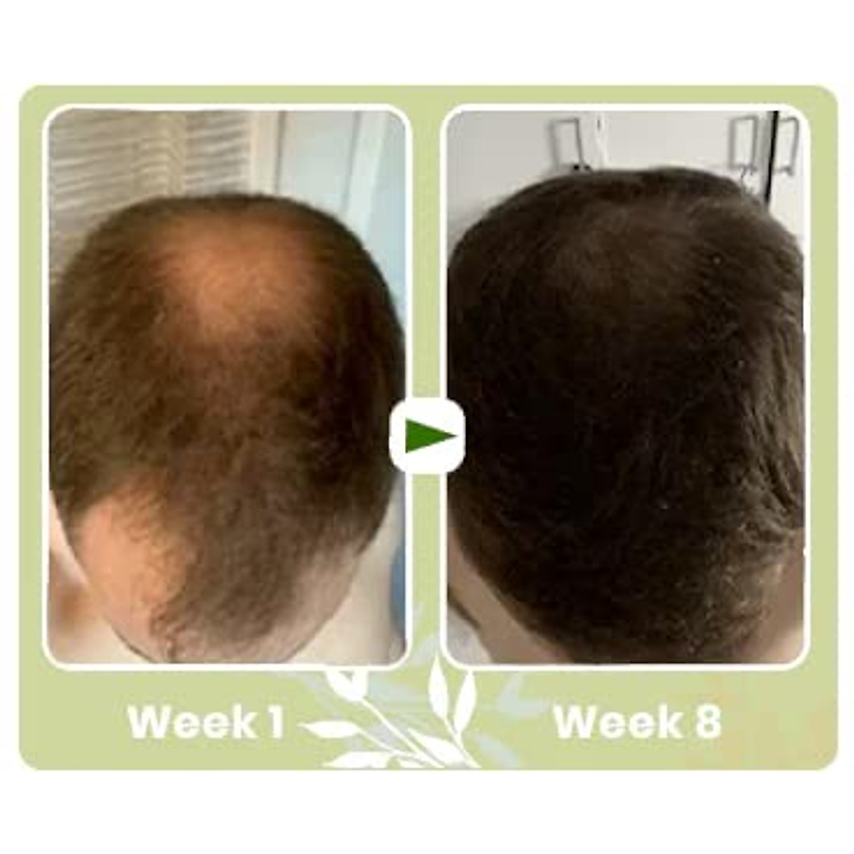 lunhaifi Hairthentic Invigorating Oat & Rice Shampoo Bar,Moisturizing Shampoo Stick,Fermented Rice Water Shampoo Bar,Rice Shampoo Bars for Hair Growth,Anti Hair Loss Rice Water Shampoo Bar (3Pcs)