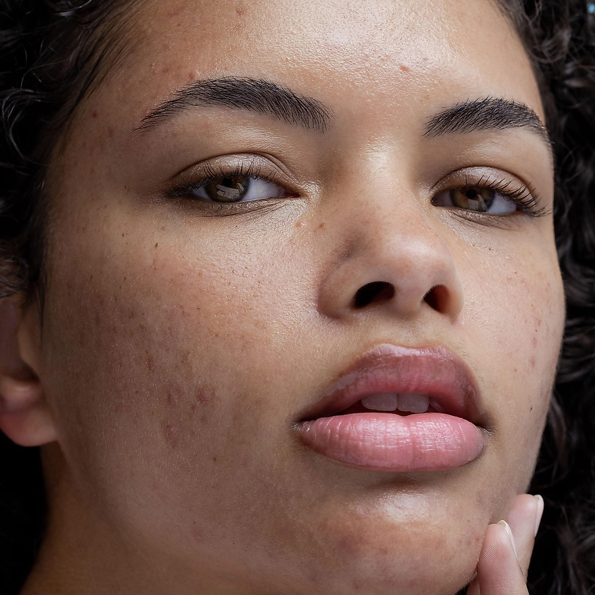 Obagi CLENZIderm M.D. Therapeutic Moisturizer – Hydrates, Soothes, Calms & Protects the Skin During Acne Treatment – 1.7 oz