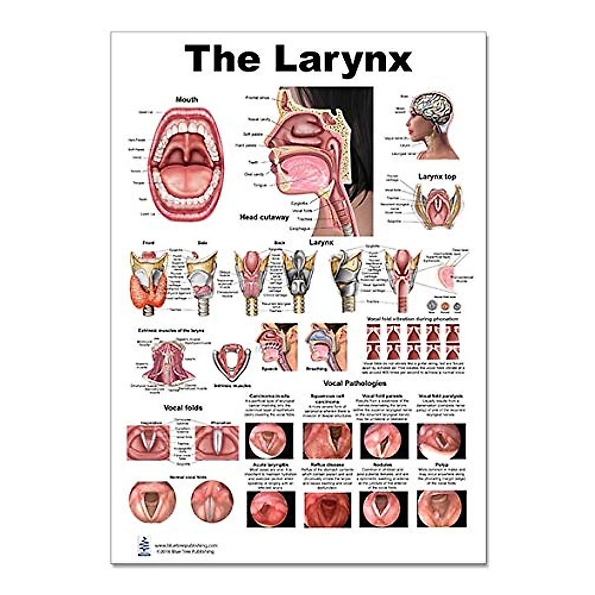 Larynx Poster, Voice, Education, Vocal Folds, Mouth, Head Cutview, Vocal Pathology, Size 12x17inch