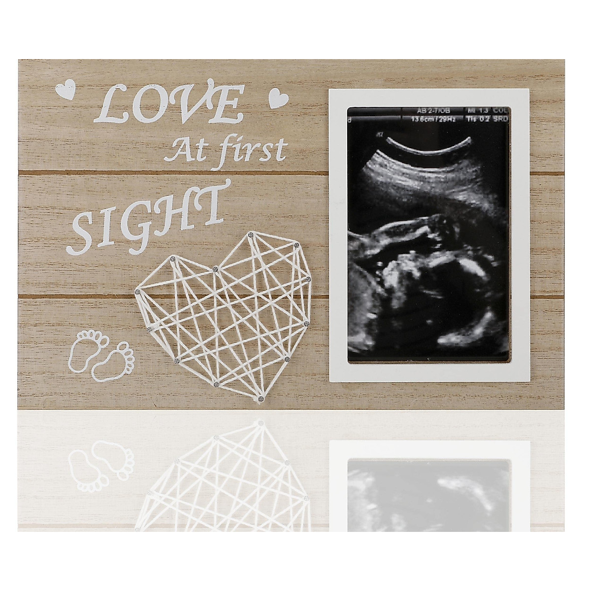 Sonogram Picture Frame - First Time Parents Gifts - Keepsake Baby Ultrasound Frame - Expecting Parents Gift - Baby Shower - Love at First Sight - Pregnancy Gifts For First Time Moms – Nursery Decor