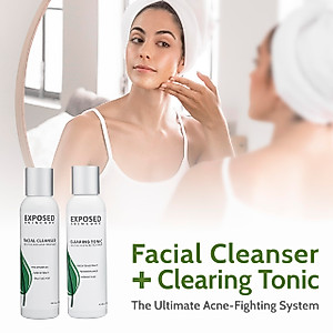 Exposed Skin Care Acne Treatment Kit - Includes Facial Cleanser, Clearing Tonic, Acne Treatment Serum, Clear Pore Serum, Clarifying Mask, Cloth - Natural Acne Solution for Face, All Ages & Skin Types