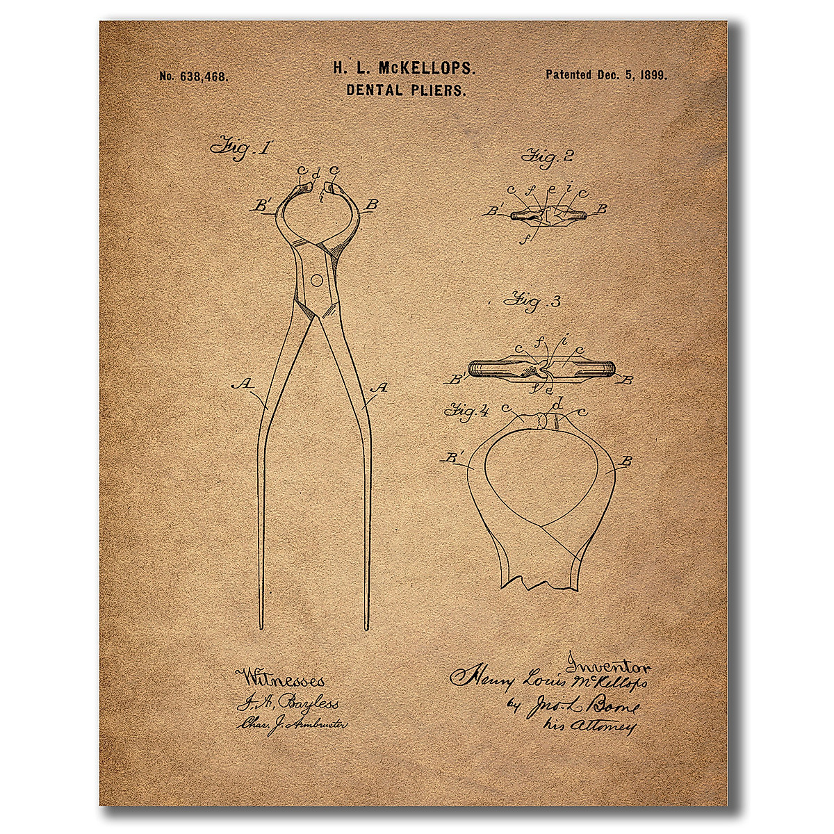 Dentist Patent Wall Art Prints - Set of 6 Vintage Replica Photos