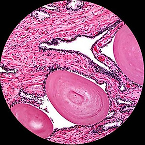 AmScope B100-E 1000X Digital Compound Binocular Microscope, 40X-1000X Magnification, Brightfield, Tungsten Illumination, Abbe Condenser, Plain Stage, Includes 0.3MP Camera and Software