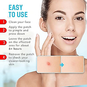 Pimple Patches (120 Pack), Hydrocolloid Acne Patches with Tea Tree Oil - Pimple Patches for Face - Zit Patch and Pimple Stickers - Hydrocolloid Acne Dots for Acne - Zit Patches - Acne