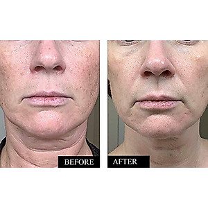 Organic Vitamin C Serum for Face with Hyaluronic Acid - Best Anti Wrinkle Facial Serum to Reduce Wrinkles, Dark Spots & Sun Damage - Anti Aging Brightening Vitamin C Face Serum for Women & Men -1.7 Oz