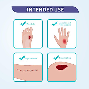Conkote Hydrocolloid Wound Dressing 4”x 4”, Sterile Adhesive Patches, Box of 10 Dressings