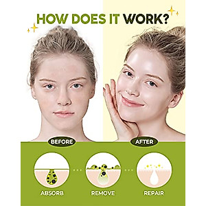 Glam Up Moisturizing Avocado Clay Mask | Vegan Clay Mask, Hydrating Avocado Face Mask for Dry Skin and Sensitive Skin, Gentle Exfoliating Deep Pore Cleansing Clay Face Mask, Blackhead remover - (125ml/4.23 Oz)