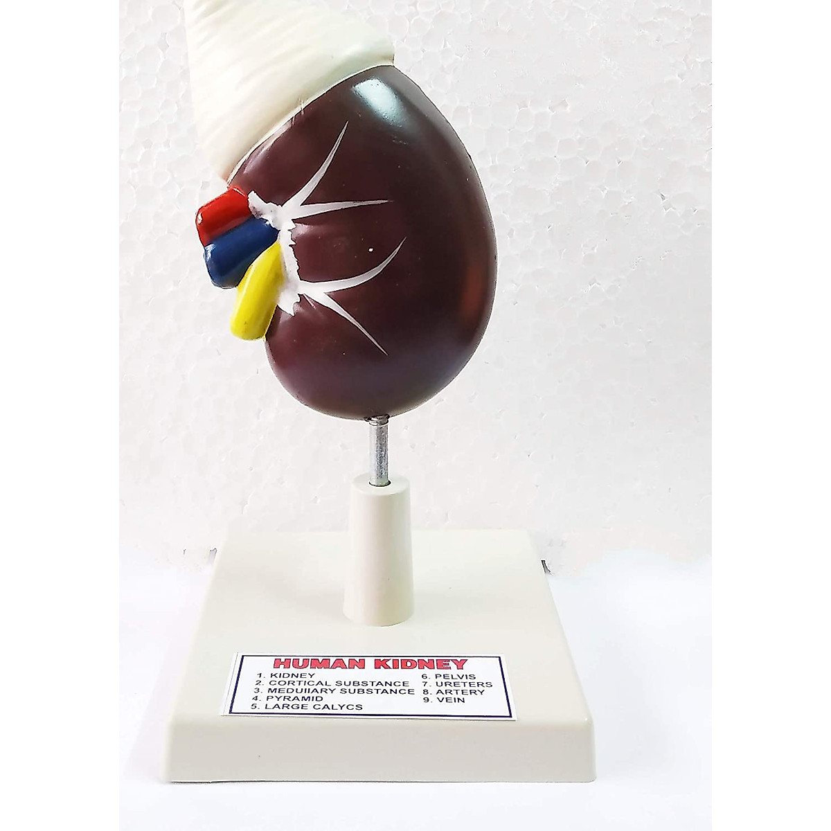 Saini MEDICOS Human Kidney Model on Stand for Labs and Schools
