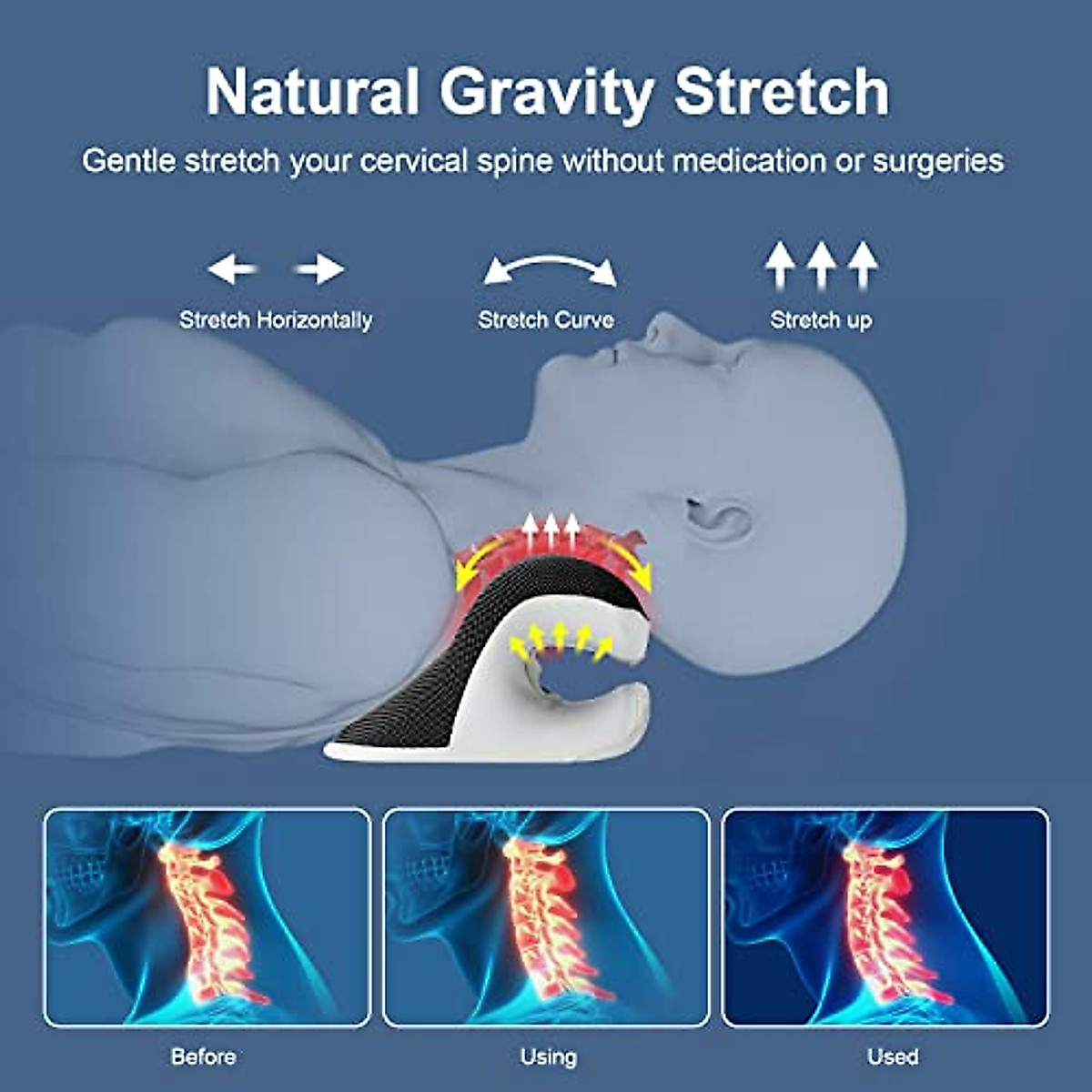 Liipoo Heated Neck Stretcher with Magnetic Therapy Pillowcase, Neck and Shoulder Relaxer Pillows, Cervical Traction Device for Relieve TMJ Headache Muscle Tension Spine Alignment…