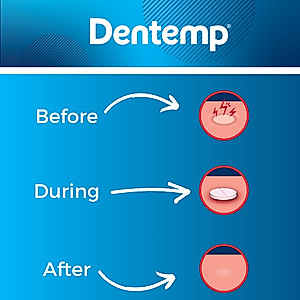 Dentemp Canker Sore Medicine 2pk Canker Cover - Oral Pain Reliever (12 Count) - Treatment to Relieve Canker Pain, Mouth Sores & Mouth Irritation - Fast Acting Canker Sore Relief Tablets for Adults