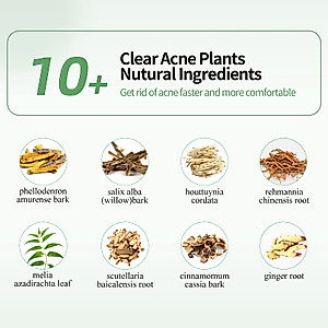 Acne Treatment Face Serum, 10% Salicylic Acid, Pimples Remover & Dead Skin Peels, Relieve Redness Rosacea Blemish, Centella Asiatica Soothing Calming, Acne Prone Sensitive Facial Skin Care, 30ml