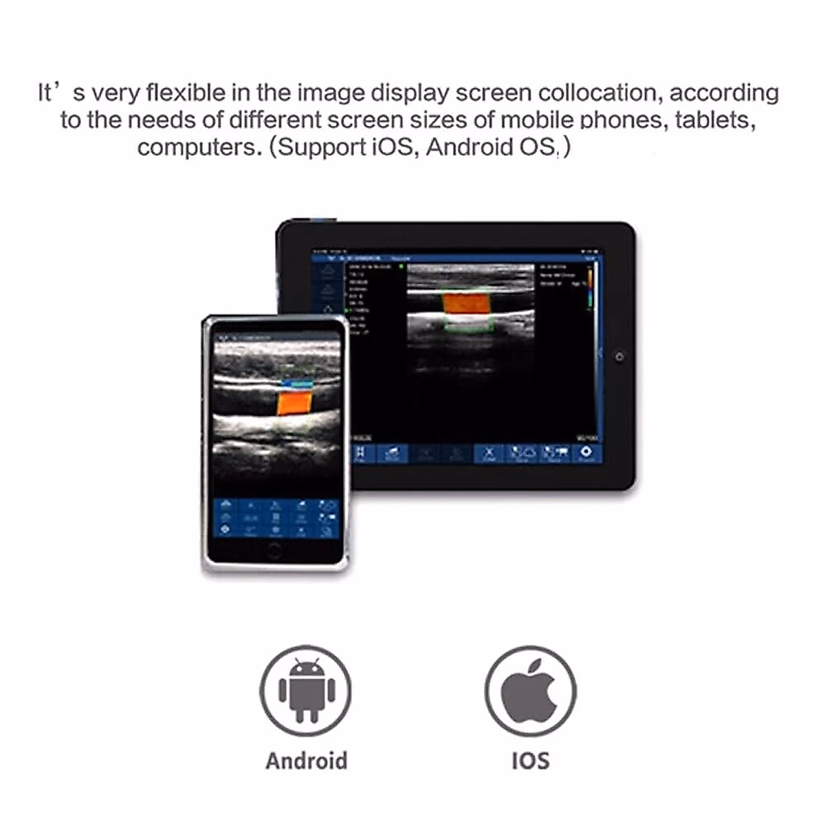CONTEC Veterinary Wireless Ultrasound Handheld Dual for Animals-Probe Color Doppler Diagnostic System 32 Channel Rechargeable.Suitable for Home,Pets Clinic,Pets Hospital and Other Occasions