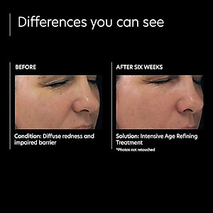 PCA SKIN Intensive Anti Aging Retinol Serum, 0.5% Pure Retinol Face Serum, Minimizes Fine Lines and Wrinkles, 1 fl oz Tube