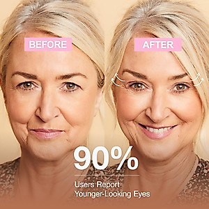 Beauty Logic Aqua Lace Eyelid Lifting Kit, 120 Invisible Lifter Tape Strips, Instant Natural Self Adhesive Upper Eye Lid Lift Double Stickers for Hooded Droopy Puffy Uneven Eyes (Medium)