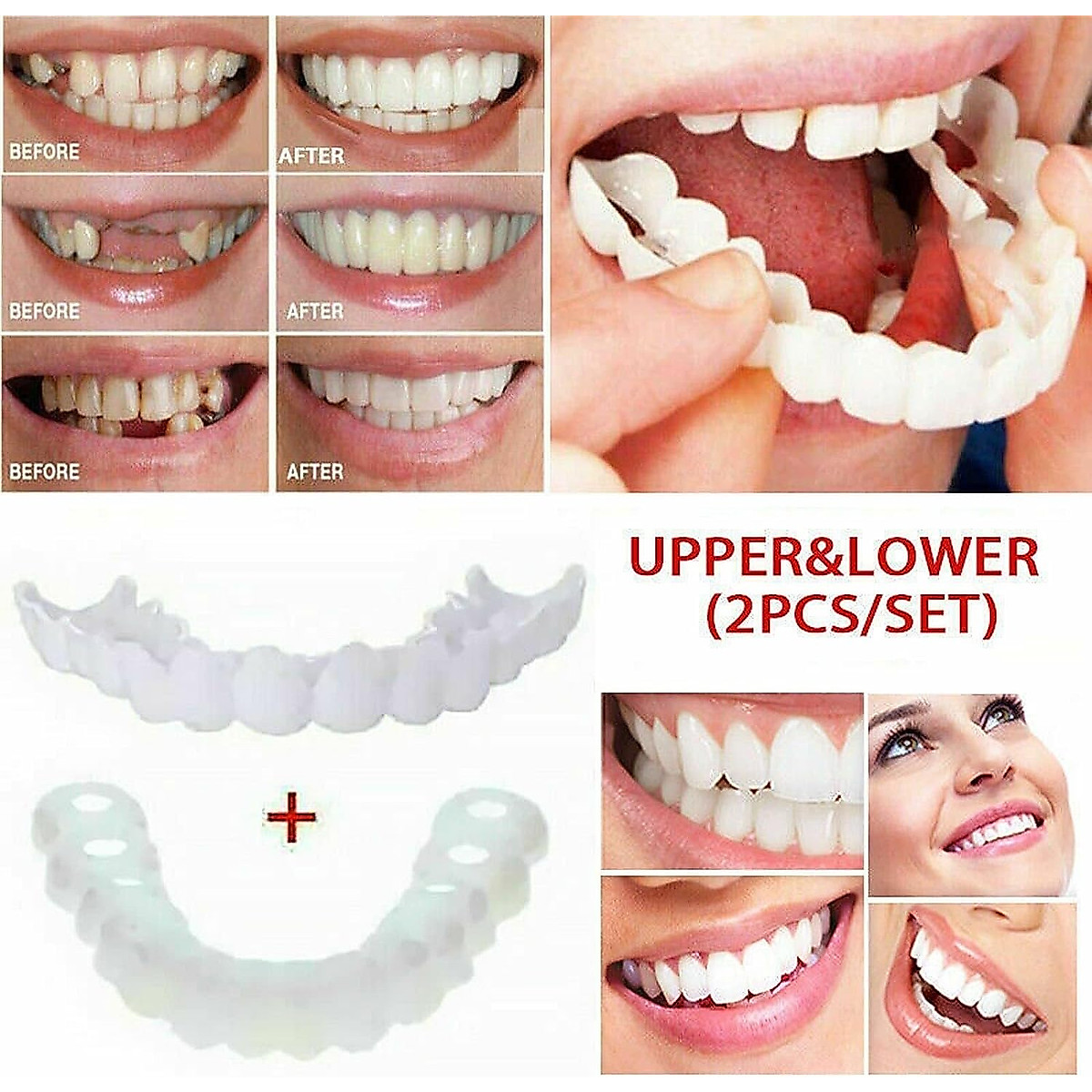 2 Pairs of occlusal Tooth veneers and Smiling Tooth veneers to Protect and Cover Imperfect Teeth, and whitening Braces to Keep Teeth White and Tidy,… (Large Size)