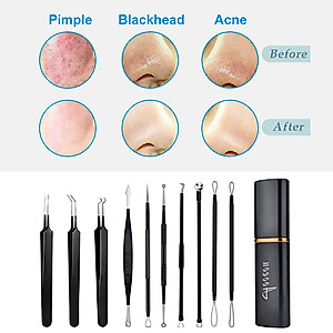 Pimple Popper Tool Kit, Aooeou 10 Pcs Professional Blackhead Extractor with Metal Case - Easy Removal for Pimples, Blackheads, Zit Removing, Forehead and Nose(Black)