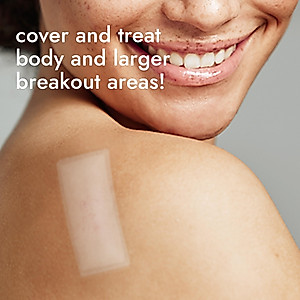 Epielle Over-Zit Acne Variety Patches | 84 Hydrocolloid Acne Pimple Patch for Covering Zits and Blemishes for Full Face (84 Counts), Easter Gift