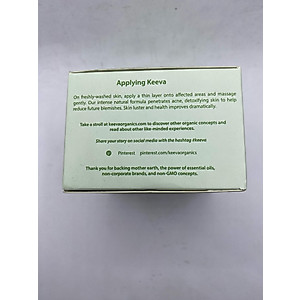 Acne Treatment Cream With Secret TEA TREE OIL Formula - Perfect For Fighting Breakouts, Spots, Cystic Acne, Acne Scar Removal - See Results in Days Without Dry Skin - by Keeva Organics (2oz)