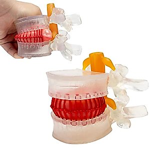 SKUMOD Human Lumbar Disc Herniation Model, Transparent Lumbar Spine Model, Lumbar Disc Anatomical Model with Elastic Software