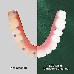 Ultrasonic U-V Cleaner for Dentures, Retainer, Mouth Guard, Aligner, Whitening Trays, Toothbrush Head, 45kHz Ultrasonic Jewelry Cleaner, 200ML Ultrasonic Retainer Cleaner Machine at-Home or Travel Use