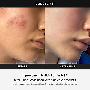 Medicube Age-R Booster H - a Facial Treatment Device for Maximizing and Boosting Skin Care Absorption - Deep Hydration, Natural Glow - Korean Skin Care