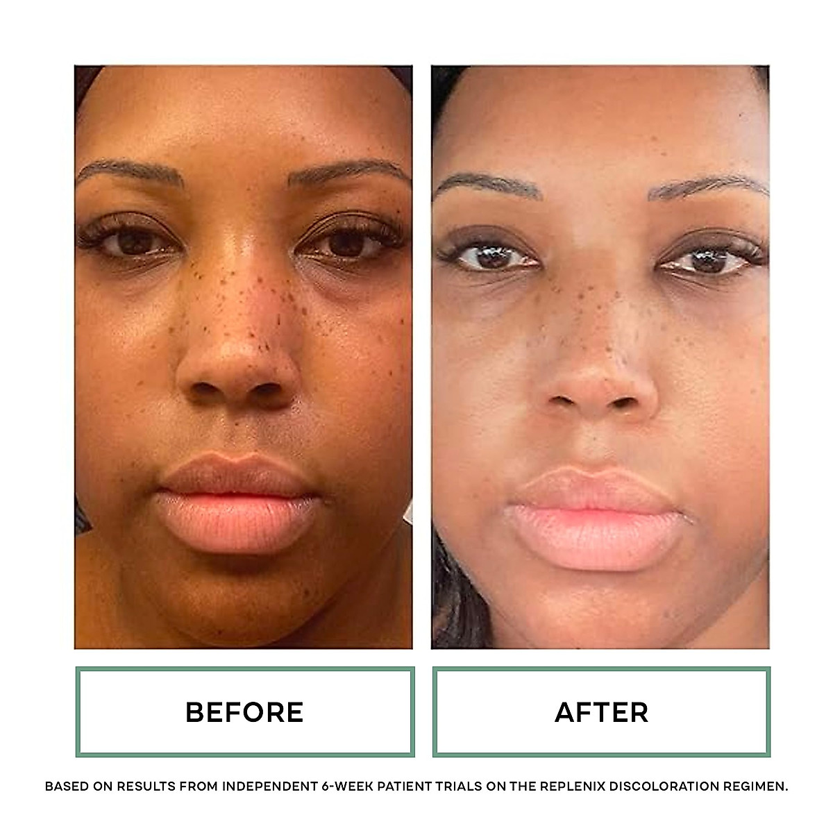 Replenix Anti-Aging Tinted Brightening Eye Cream with Medical Grade Hyaluronic Acid (8.5 ml)