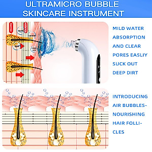 Popular Blackhead Remover Pore Vacuum Cleaner - PORTIGALIES USB Rechargeable Water Cycle Pore Cleanser 3 Adjustable Suction Modes 6 Suction Probe