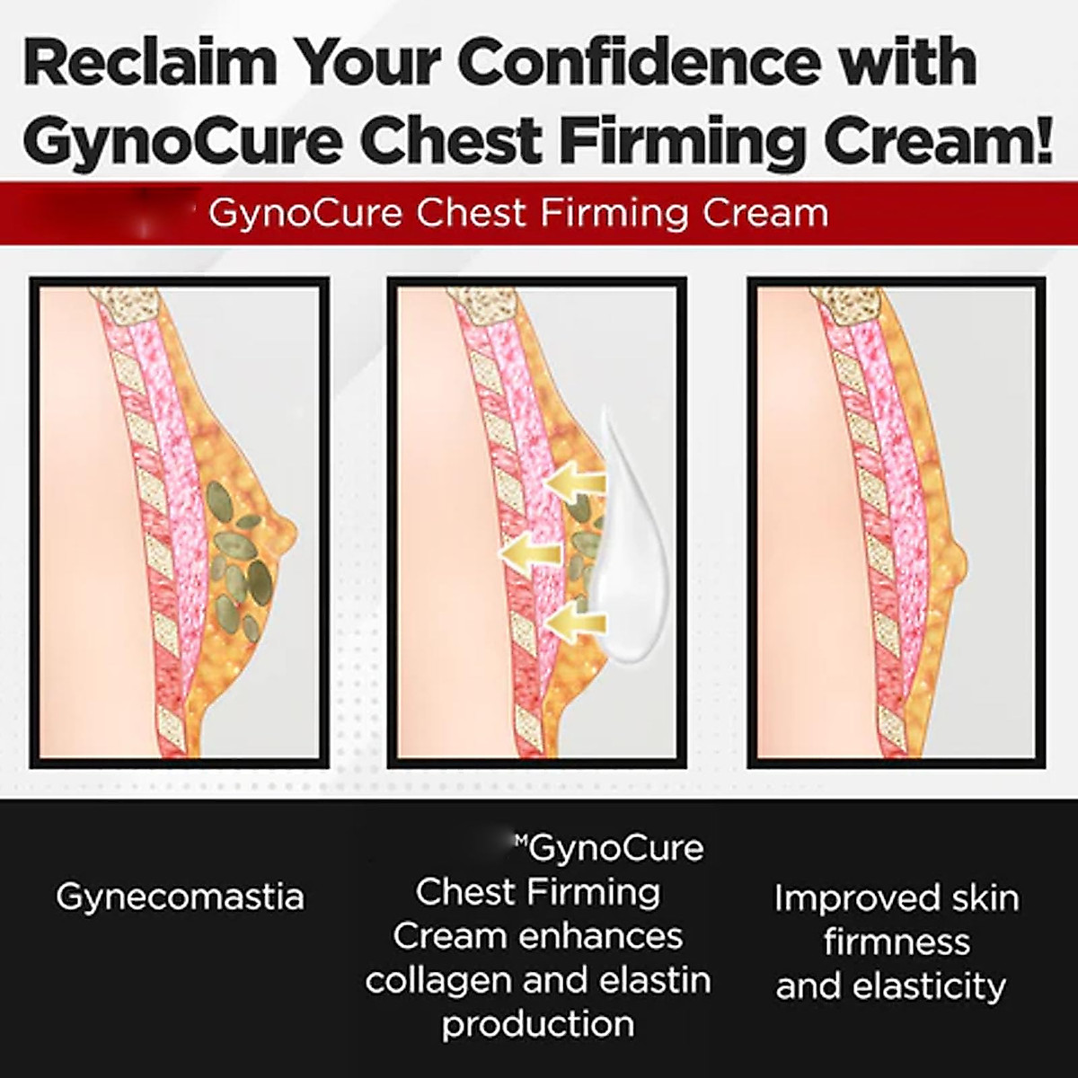 SLPB Gynocure Chest Firming Cream, 60g Gynecomastia Tightening Cream for Men, Hot Cream Anti Cellulite Cream (1Pcs)