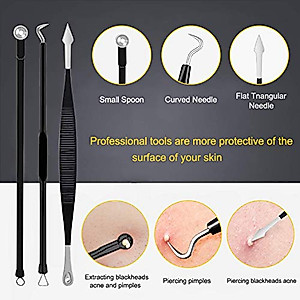 Pimple Popper Tool Kit - Boxoyx 10 Pcs Blackhead Remover Comedone Extractor Kit with Box for Quick and Easy Removal of Pimples, Blackheads, Zit Removing, Forehead,Facial and Nose (Black)