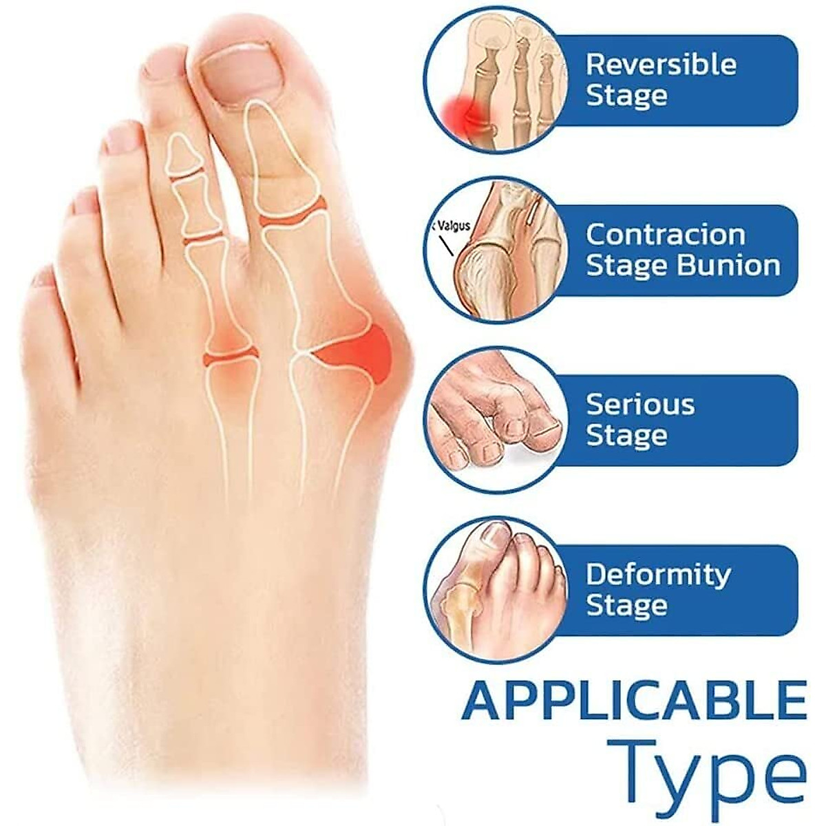 5 Pairs Sock Align Toe Socks for Bunion,Orthopedic Compression Socks,Projoint Antibunions Health Sock,Women Toe Socks No Show Low Cut Five Finger Socks (5Pairs-E)