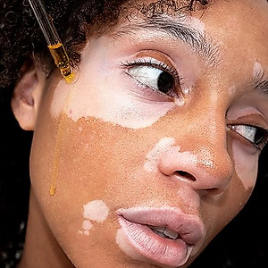 UpCircle Organic Face Serum With Coffee Oil 1oz - Vitamin C, Rosehip Oil Fades Dark Spots + Sea Buckthorn Keeps Skin Supple - Natural Hydrating Facial Oil - Vegan + Cruelty-Free