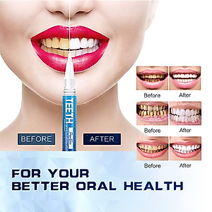 Teeth Whitening Pen, Use Twice a Day Up to 1-6 Shade Whiter in 1-2 Weeks, 4 No Sensitivity Pens, 70+ Whitening Treatments, Effective, Pain Free and Enamel Safe, Easy to Use at Home Travel, Flavourless