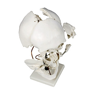 Vision Scientific VAL250 Life Size Beauchene Model | “Exploded” to Show How Bones Fit Together | Disarticulated, Mounted on Wire to Retain Spatial Relationship | Med. Studies | W Identification Key