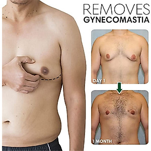 Aolodoo SoliPac Gynecomastia Tightening Ginger Cream,Gynecomastia Tightening Ginger Cream,Fat Burning Anti-Cellulite Slimming Cream,Effective Remove Excess Fat (3pcs)