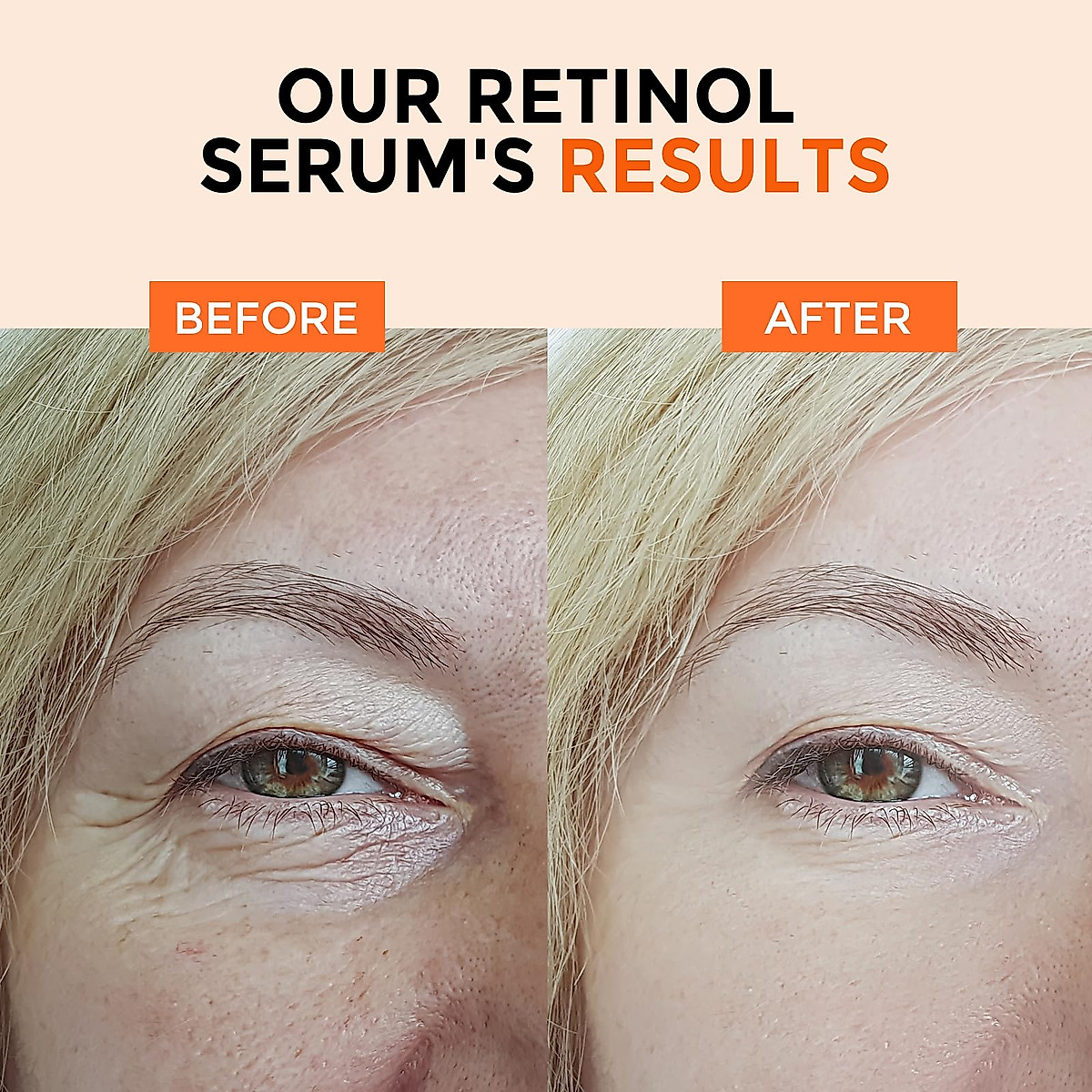 Retinol Serum for Face 2.5%, B5 Resurfacing Retinol Serum with Vitamin C, Vitamin E, Hyaluronic Acid, Niacinamide, Serum for Anti-Aging, Wrinkle Smoothing, Dark Spot Corrector, Brighten Dullness