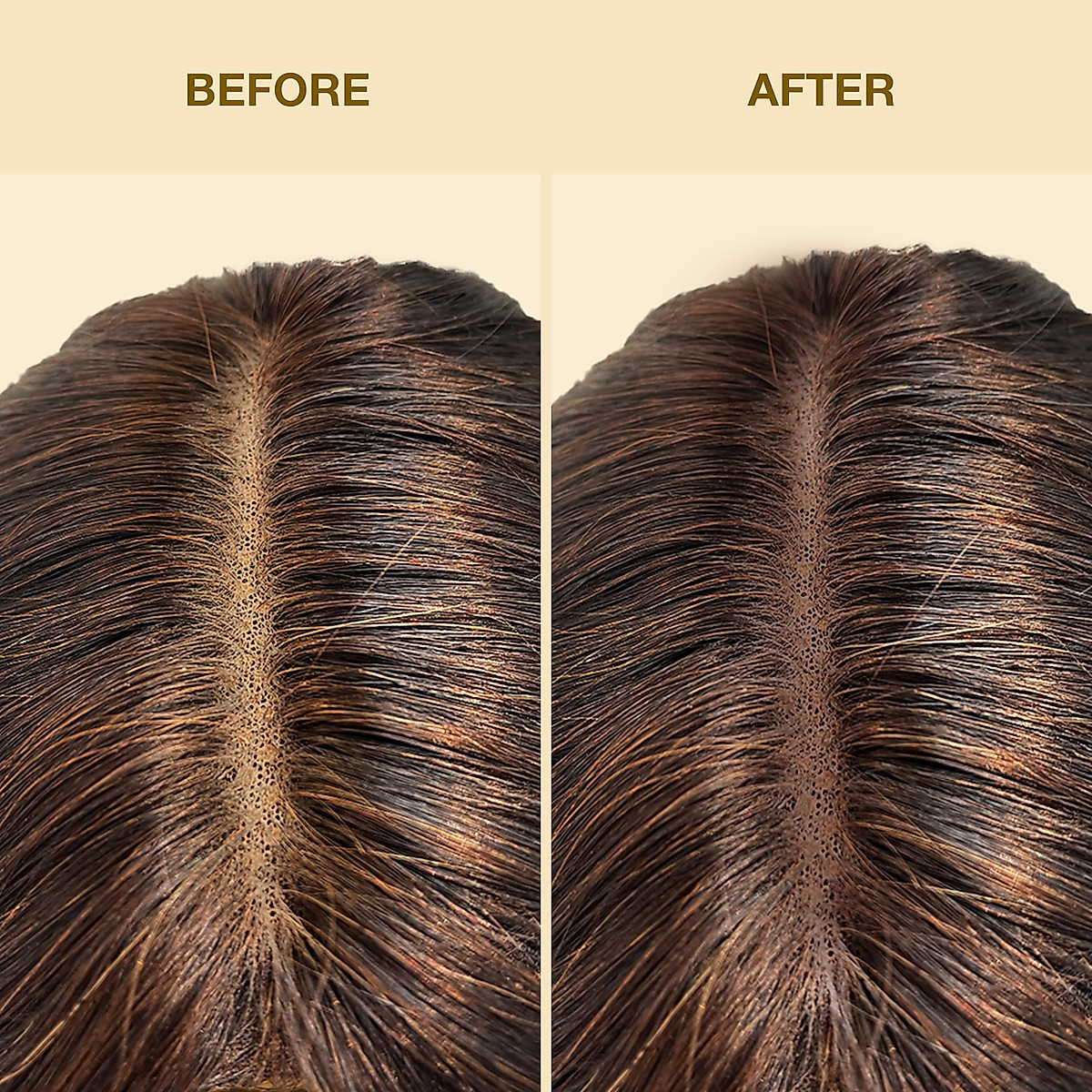 EBIN NEW YORK Tinted Lace Spray - Medium Dark Brown 2.7oz/ 80ml, Quick dry, Water Resistant, No Residue, High pigmentation, Even Spray, Matching Skin Tone, Natural Look, Tinted Spray for Wig