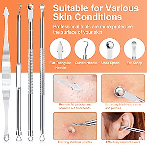 Pimple Popper Tool Kit, IUMAKEVP 15 PCS Professional Stainless Steel Blackhead Remover Comedone Extractor Tools for Removing Zit on Face - Acne Removal Kit with Metal Case (Silver)