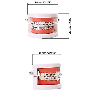 QWORK Typodonts Orthodontics Demonstration Model, Dental Tooth Research Model with Metal Wires and Ceramic Brackets, Teaching Teach Explanation Model for Adults